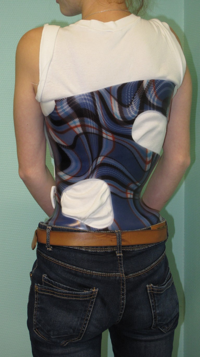 Corset de scoliose – Orthopedic'Mans